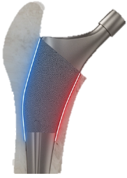 Watson Extraction System