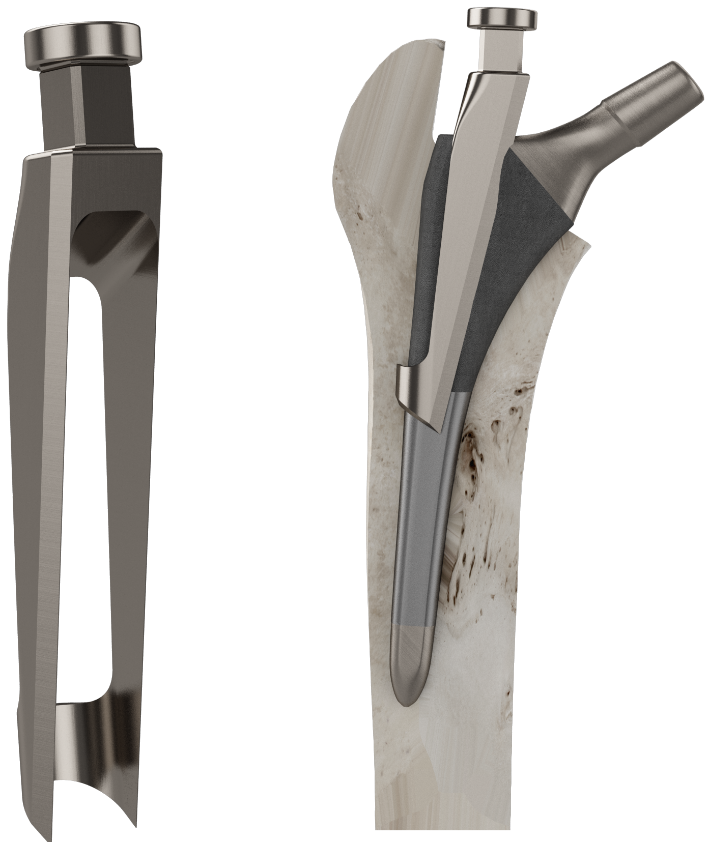 Watson Extraction System